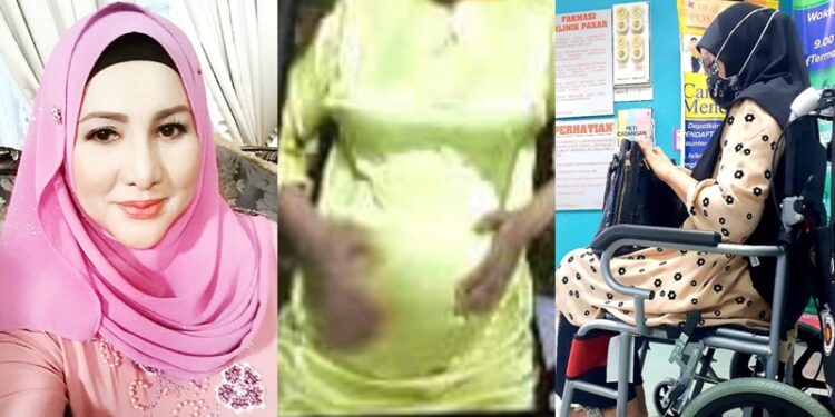 Kanser perut sebesar bola, Emma Akma perlu bantuan kos pembedahan ...