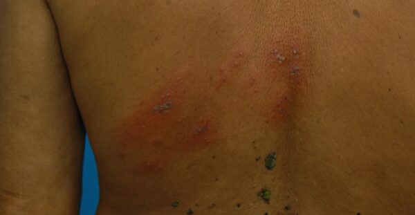 Kayap ular bersambung boleh bawa maut hanya mitos - Kosmo Digital