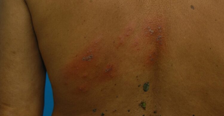 Kayap ular bersambung boleh bawa maut hanya mitos - Kosmo Digital