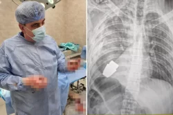 Grenad hidup dalam badan askar Ukraine - Kosmo Digital