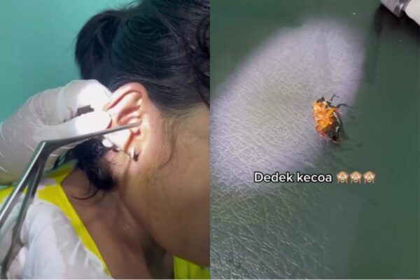 Netizen geli lipas mati ‘berkubur’ dalam telinga pesakit - Kosmo Digital