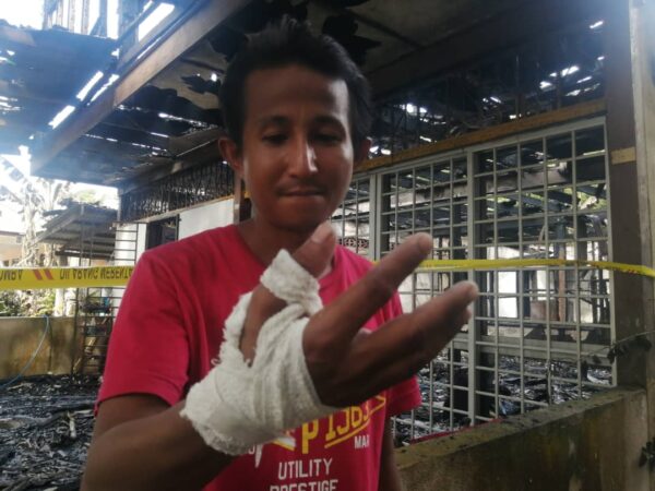 Lecur tangan, tapak kaki cuba padam kebakaran - Kosmo Digital