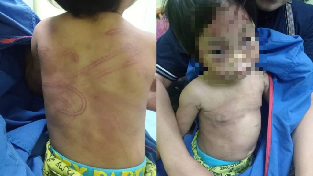 Kanak-kanak dua tahun didera kekasih ibu disahkan selamat - Kosmo Digital