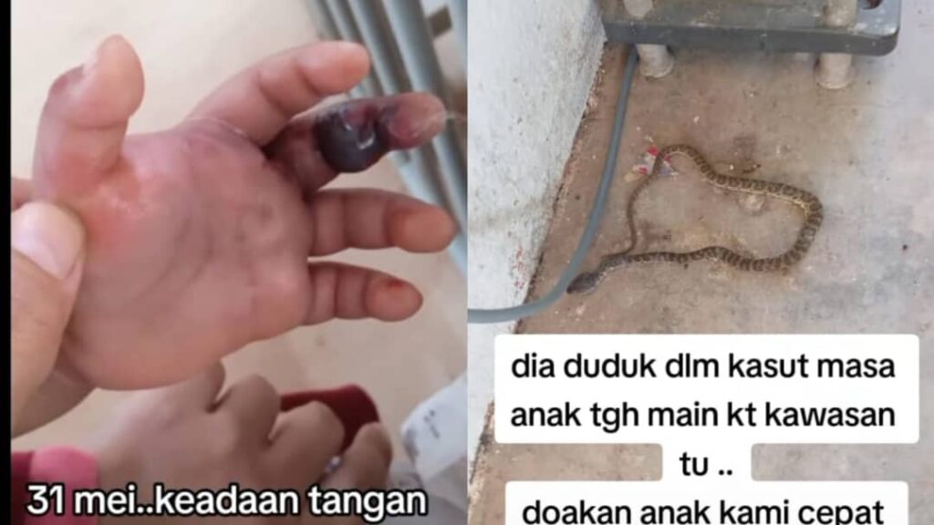Bapa cemas anak dipatuk ular sembunyi dalam kasut - Kosmo Digital Bapa cemas anak dipatuk ular sembunyi dalam kasut - Kosmo Digital