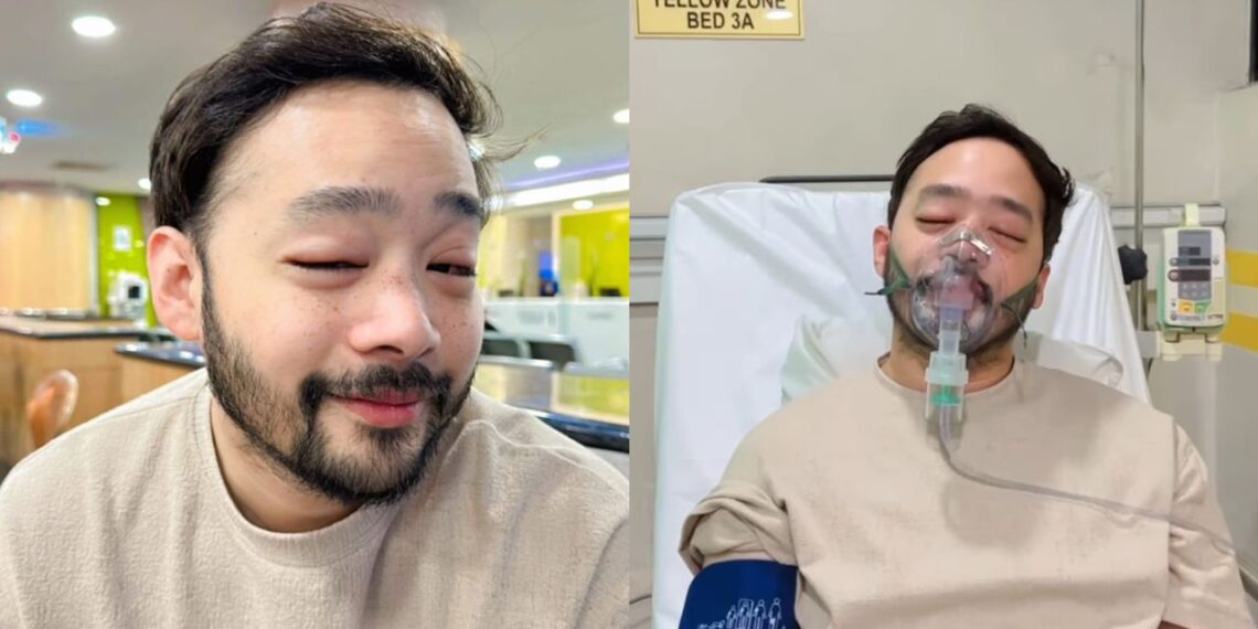 Sebab salah makan ubat, wajah Nabil Mahir membengkak - Kosmo Digital