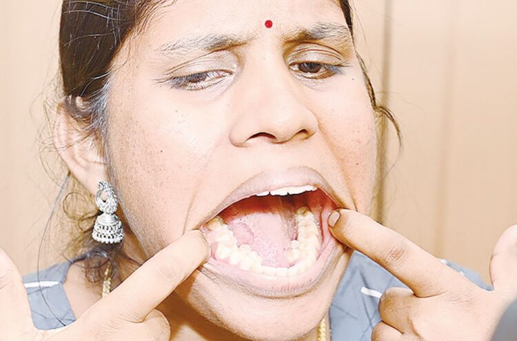 Wanita 38 gigi diiktiraf rekod dunia - Kosmo Digital