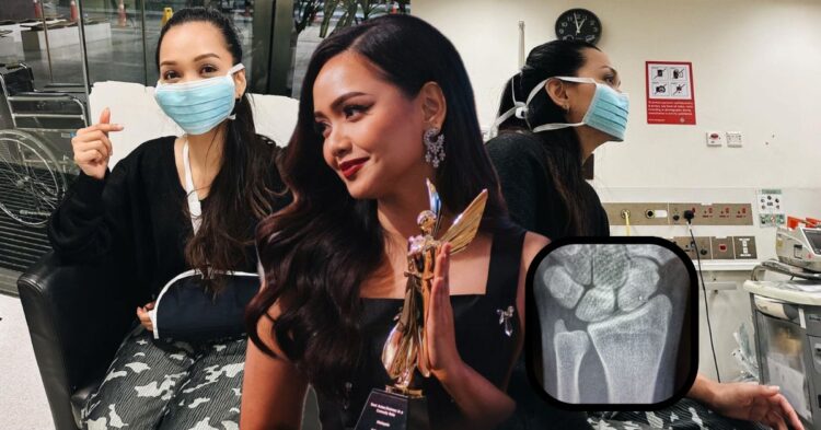 Terjatuh ketika 'shooting', pergelangan tangan Azira Shafinaz retak ...