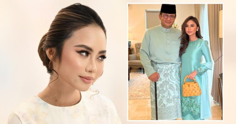 Bukan bertongkat ikut trend, suami jatuh kuda - Intan Najuwa - Kosmo ...