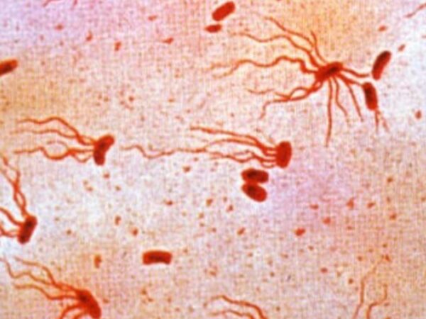 Pengendali makanan disyaki punca demam kepialu di sekolah - Kosmo Digital