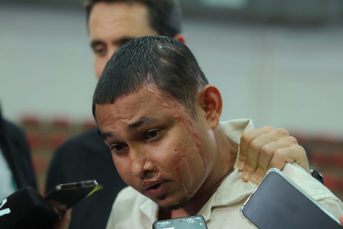 Kes simbah asid Faisal Halim diklasifikasi 'tiada tindakan lanjut ...