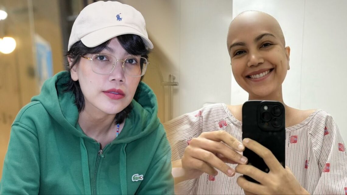 Mahu mereka sedar botak itu okey, cantik - Elyana - Kosmo Digital